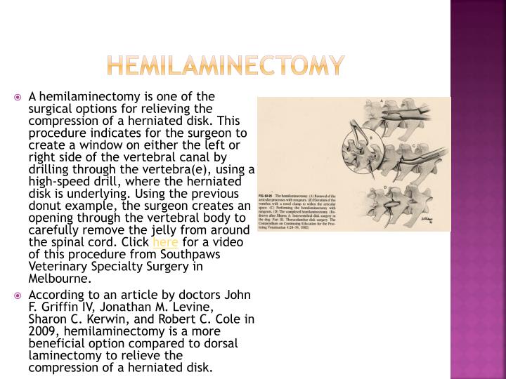 Hemilaringectomia