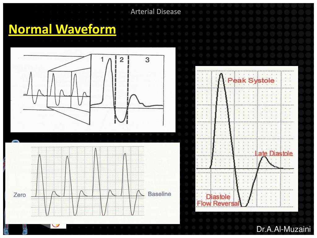 PPT - Dr.AbdulAziz Al Muzaini PowerPoint Presentation, free download ...