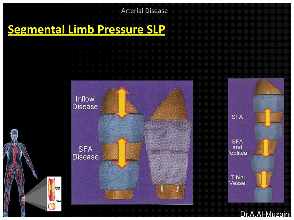 PPT - Dr.AbdulAziz Al Muzaini PowerPoint Presentation, free download ...