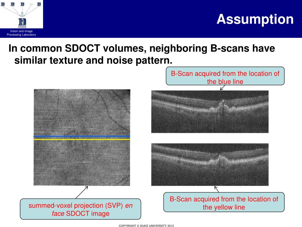 PPT - Sparsity Based Denoising of Spectral Domain Optical Coherence ... PPT - Sparsity Based Denoising of Spectral Domain Optical Coherence ...