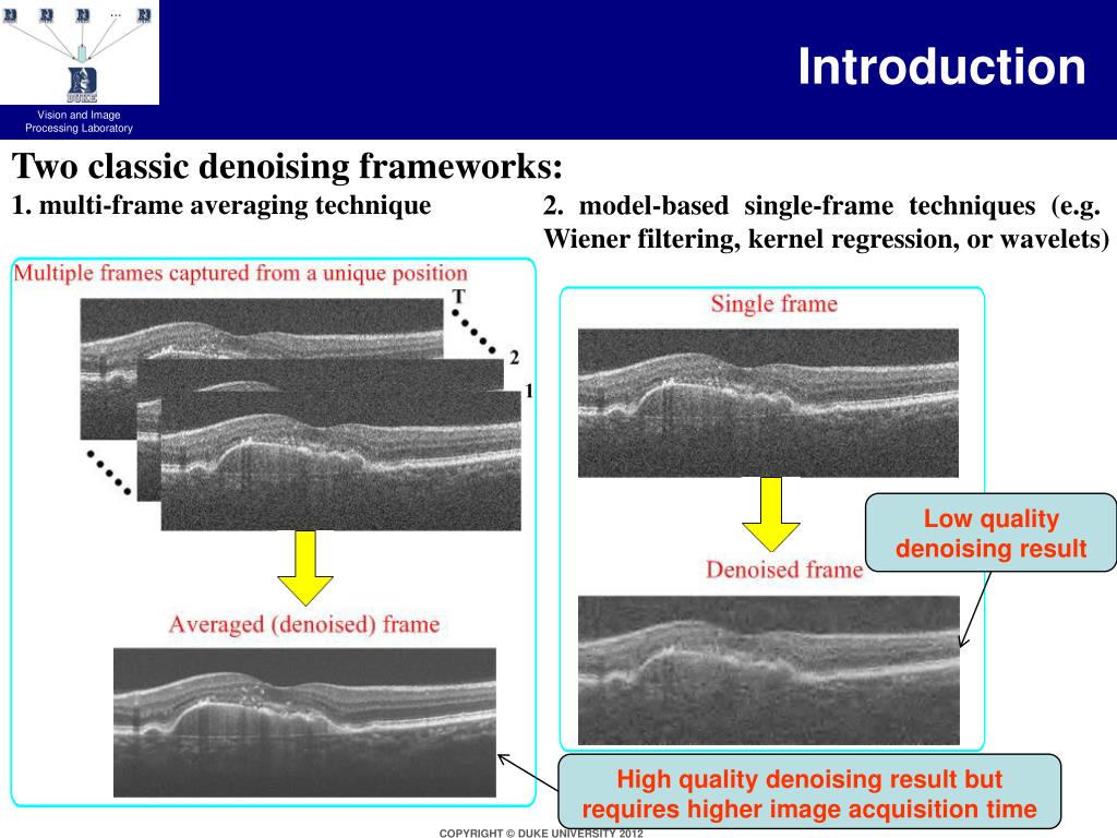 PPT - Sparsity Based Denoising of Spectral Domain Optical Coherence ... PPT - Sparsity Based Denoising of Spectral Domain Optical Coherence ...