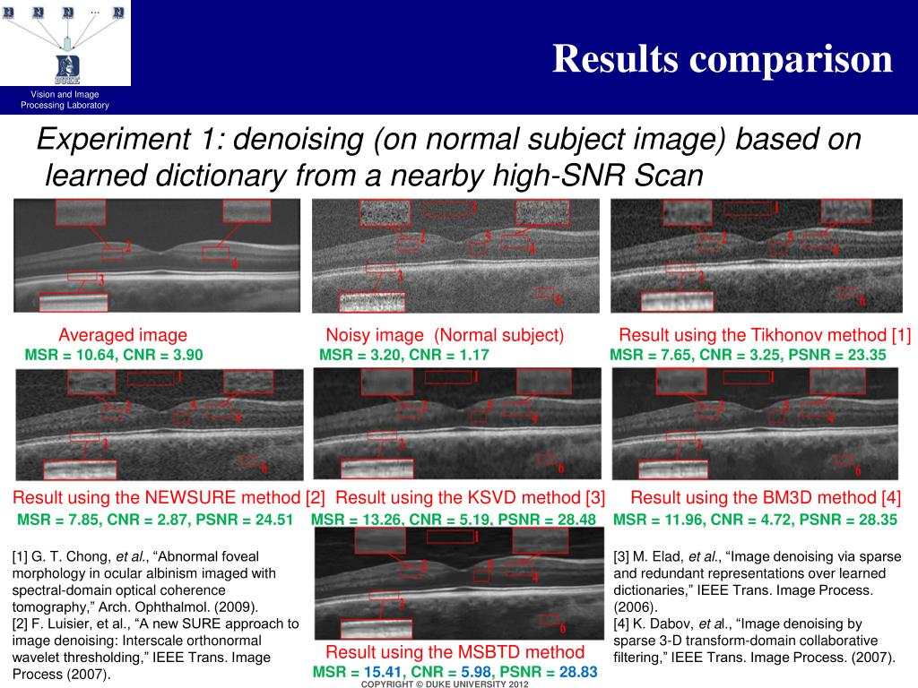 PPT - Sparsity Based Denoising of Spectral Domain Optical Coherence ... PPT - Sparsity Based Denoising of Spectral Domain Optical Coherence ...