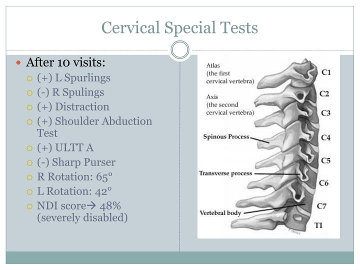 PPT - Cervical Radiculopathy Following MVA PowerPoint Presentation - ID ...