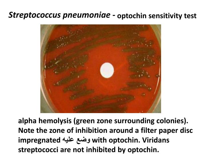 PPT - Gram Stain of a Clinical Specimen of Candida albicans PowerPoint ...
