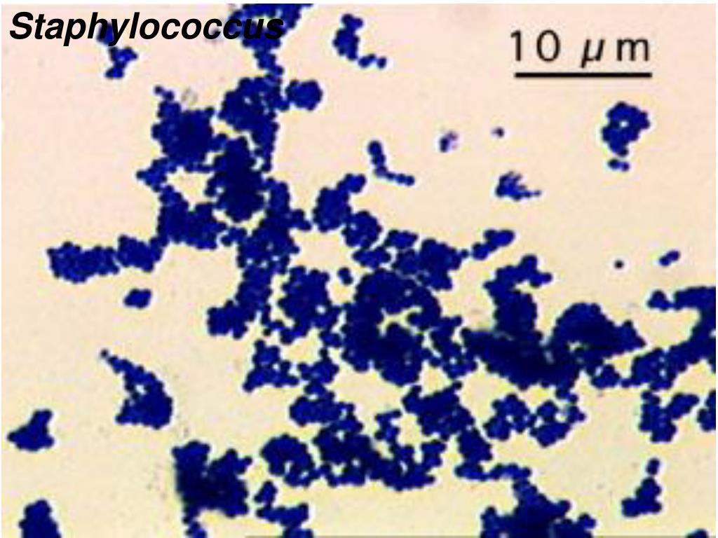 PPT - Gram Stain of a Clinical Specimen of Candida albicans PowerPoint ...