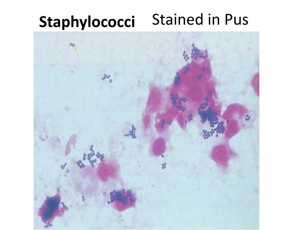 PPT - Gram Stain of a Clinical Specimen of Candida albicans PowerPoint ...