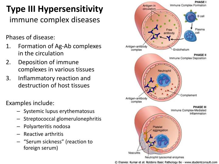 PPT - Diseases of the Immune System and Neoplastic Disease PowerPoint ...