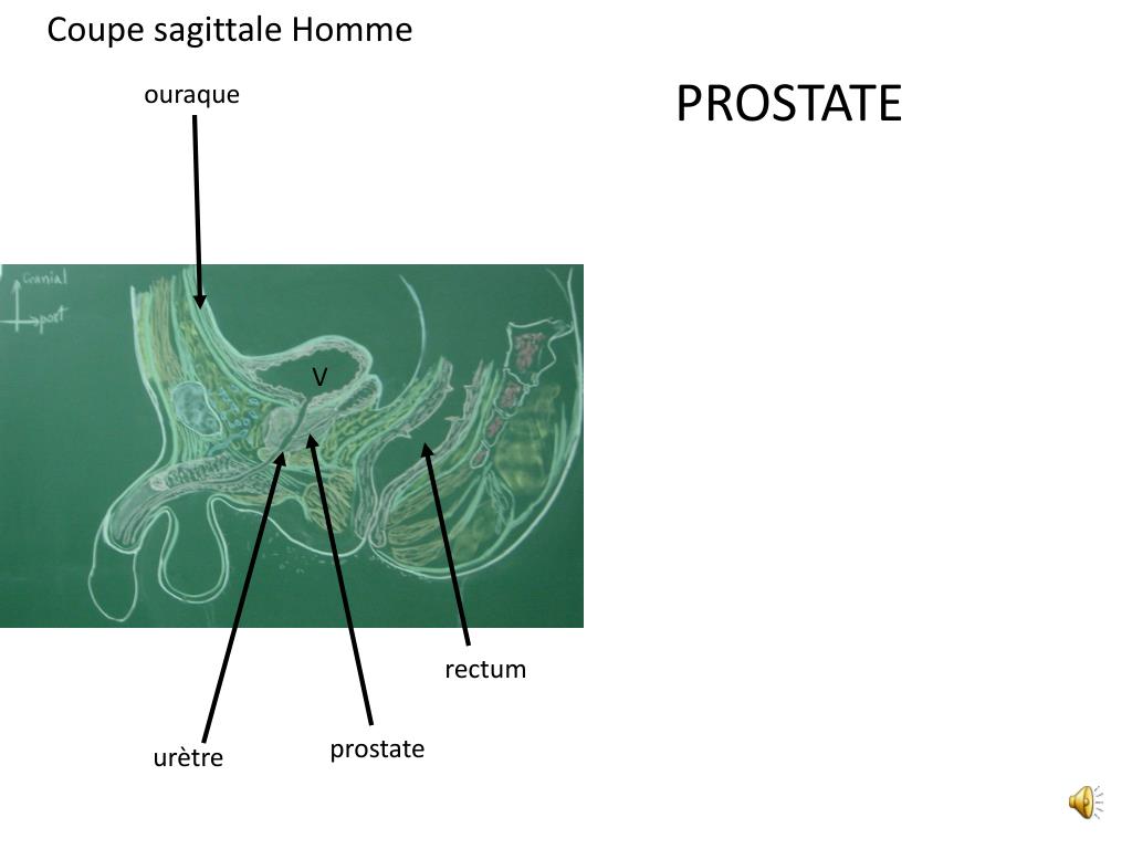 PPT - GLANDES GÉNITALES MASCULINES ANNEXES PowerPoint Presentation ...