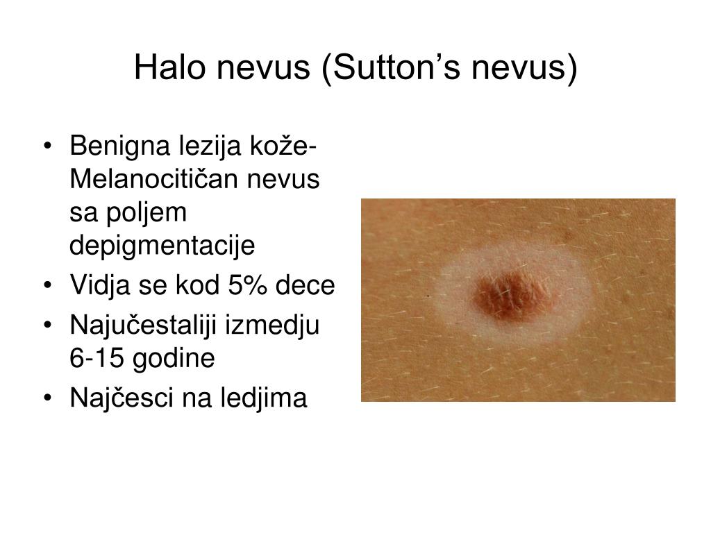 PPT - Sta pedijatar treba da zna o mladežima ? PowerPoint Presentation ...