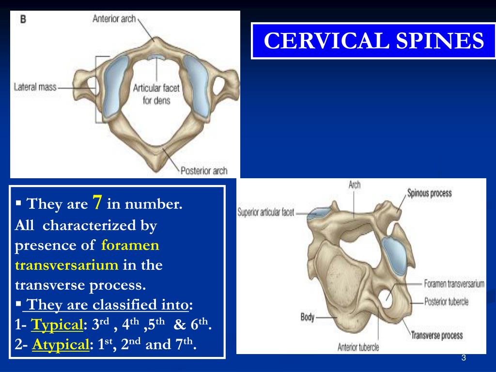 Ppt Cervical Vertebrae Powerpoint Presentation Free Download Id