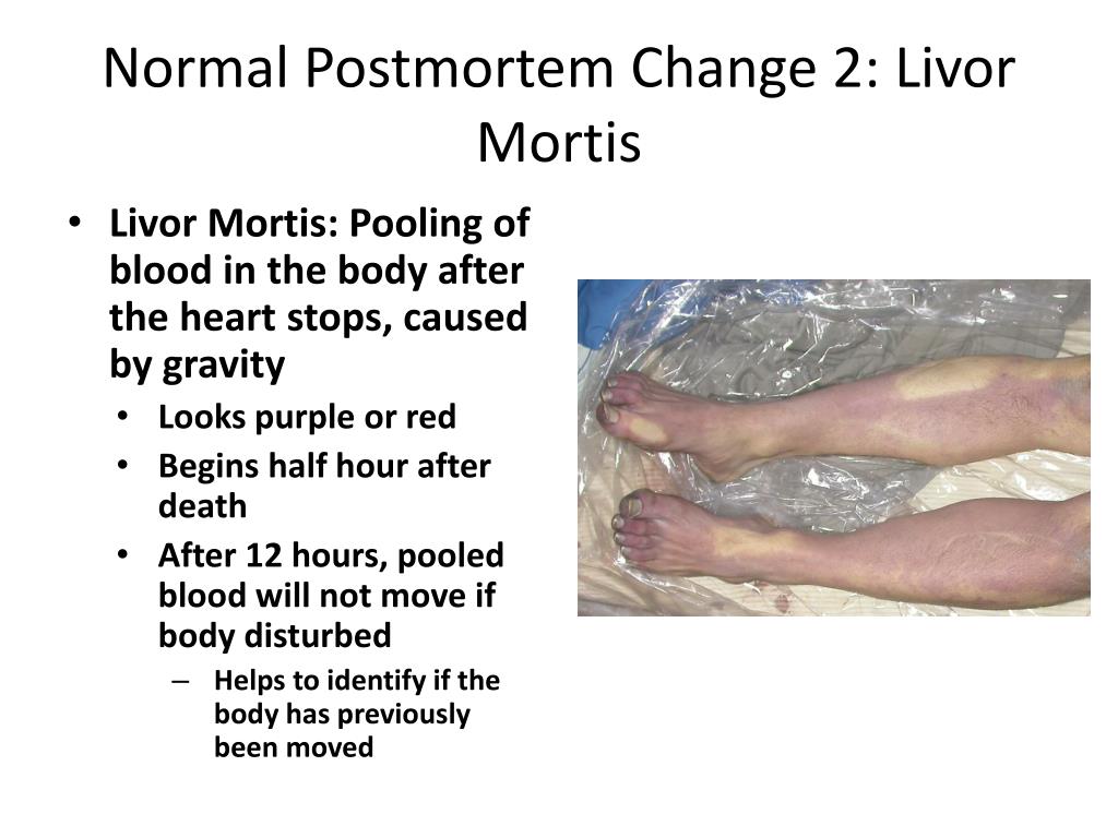 PPT - Serology, Forensic Pathology, & Entomology PowerPoint Presentation - ID:2015947