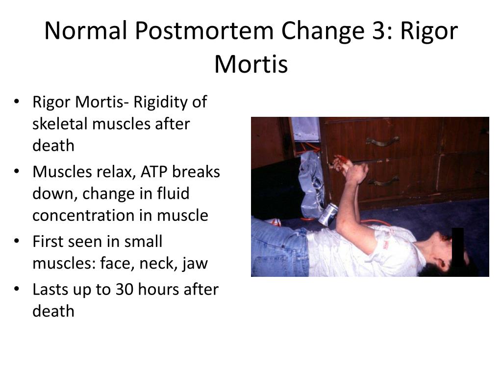 PPT - Serology, Forensic Pathology, & Entomology PowerPoint Presentation - ID:2015947
