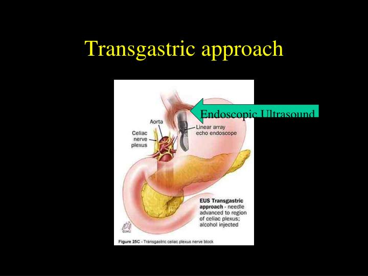 PPT - Coeliac Plexus Block PowerPoint Presentation - ID:2016538