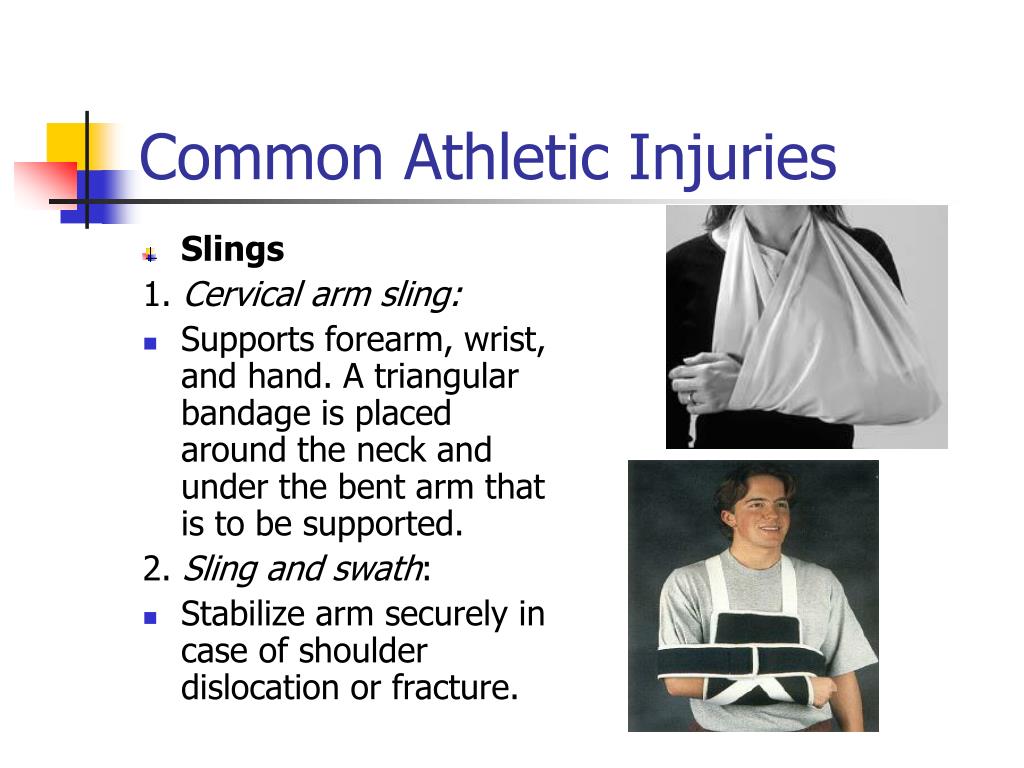 PPT - Care , Prevention and Rehabilitation of Sports Injuries Common ...
