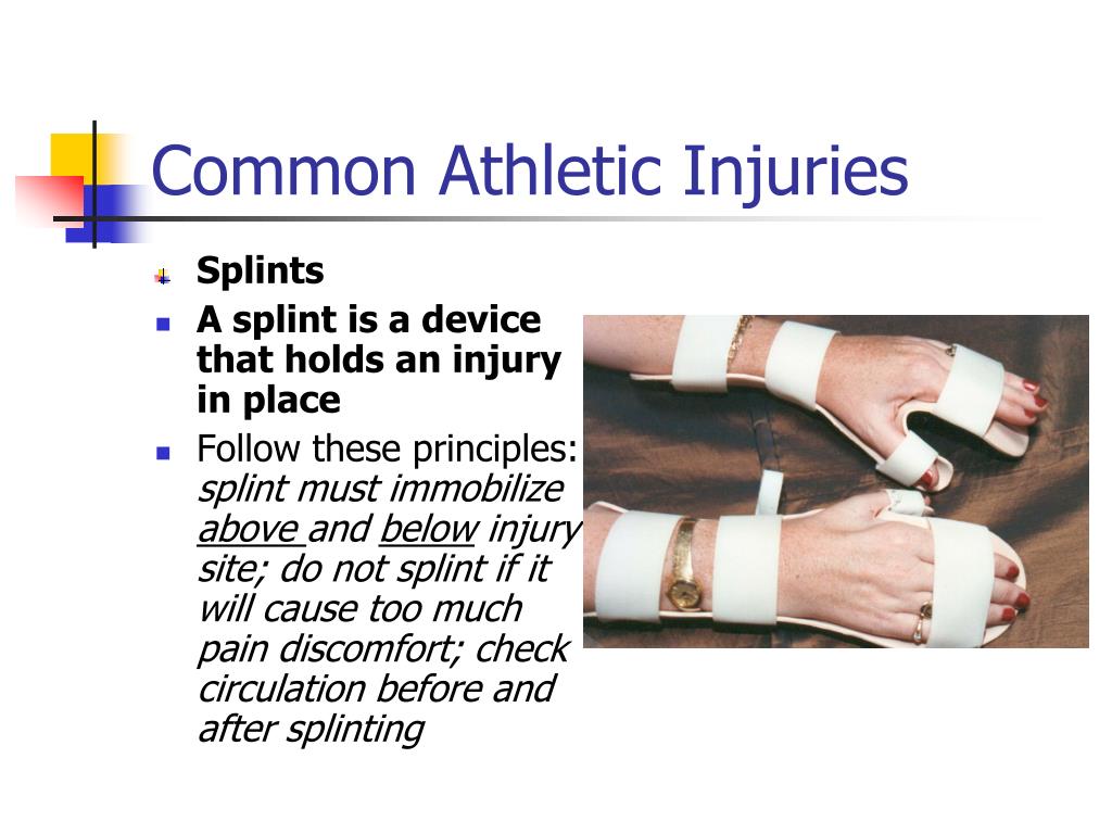 PPT - Care , Prevention and Rehabilitation of Sports Injuries Common ...