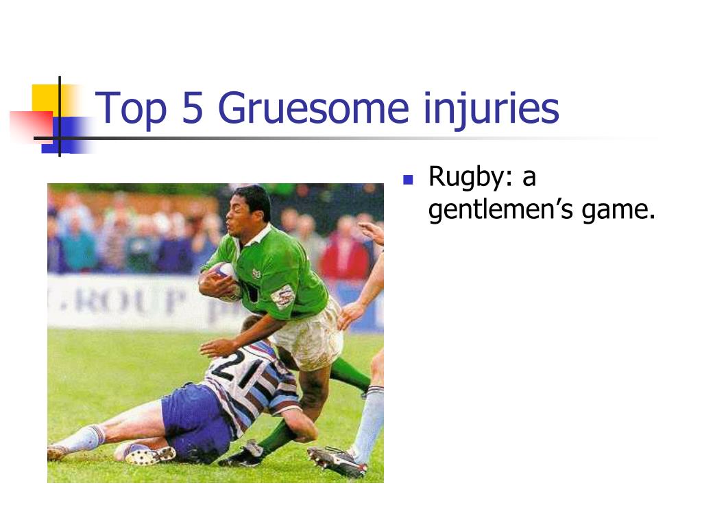 PPT - Care , Prevention and Rehabilitation of Sports Injuries Common ...