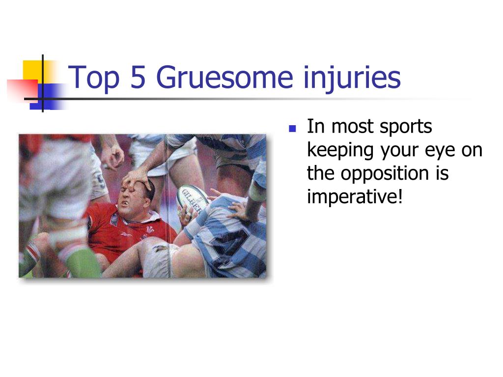 PPT - Care , Prevention and Rehabilitation of Sports Injuries Common ...