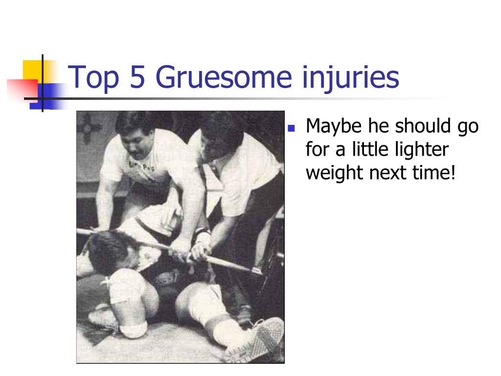 PPT - Care , Prevention and Rehabilitation of Sports Injuries Common ...