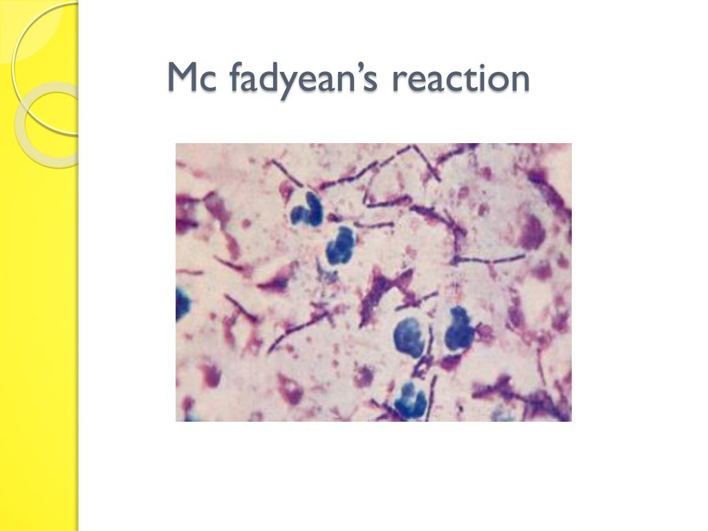 PPT - CLINICAL FEATURES EPIDEMIOLOGY LAB DIAGNOSIS PROPHYLAXIS ...