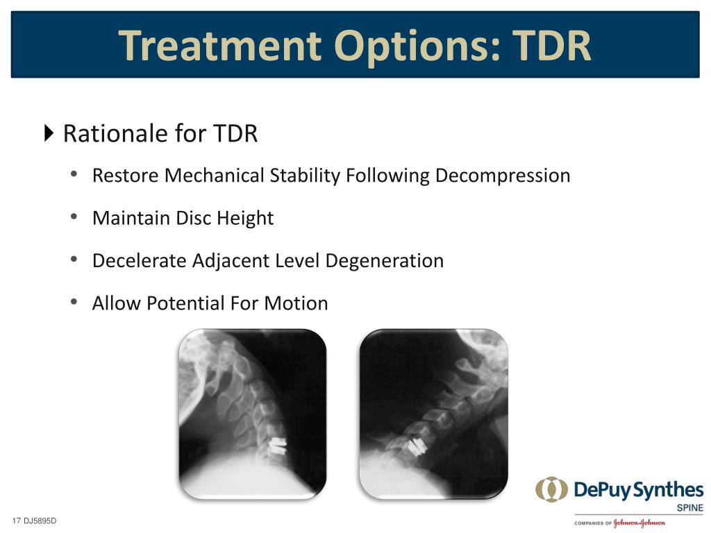 PPT - A Clinical Review of Cervical and Lumbar Arthroplasty PowerPoint ...