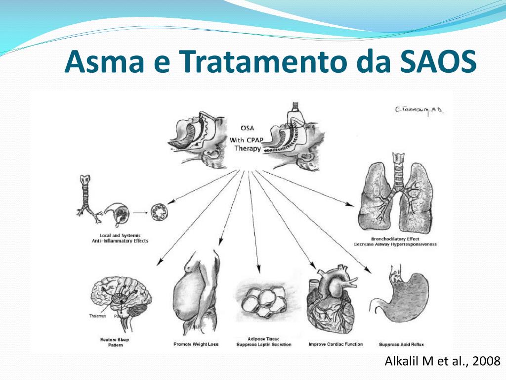 PPT - Investigação e tratamento de SAOS nos pacientes com pneumopatias ...