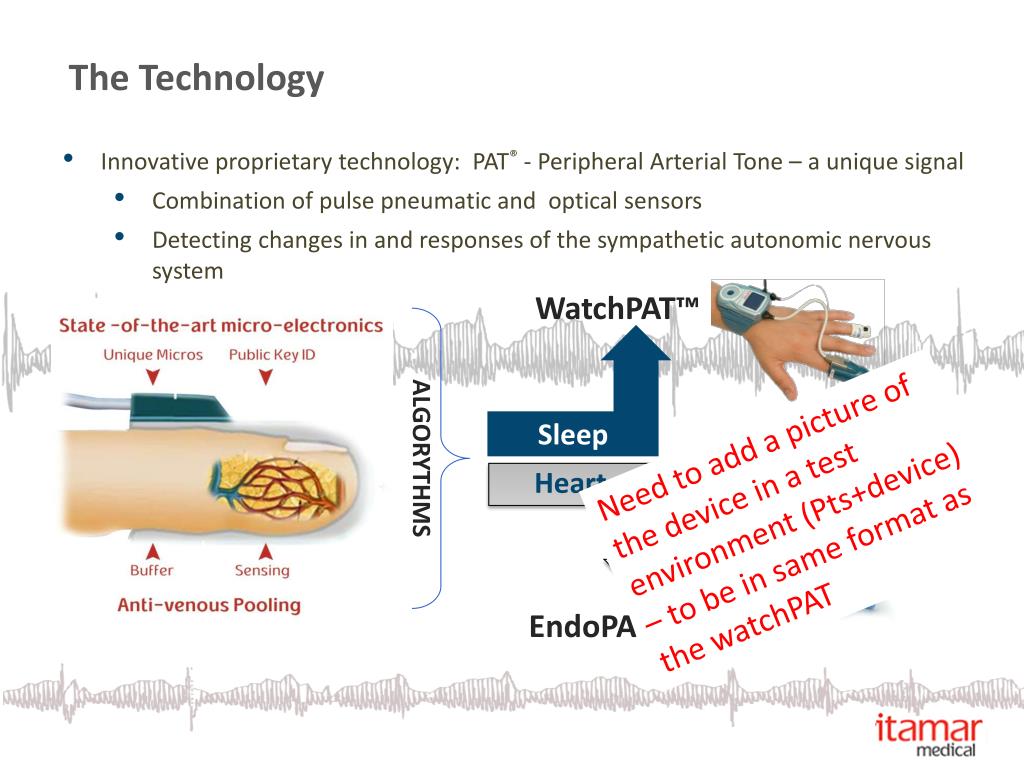PPT - Itamar Medical Ltd. Transferring Great Science into Patient Care ...