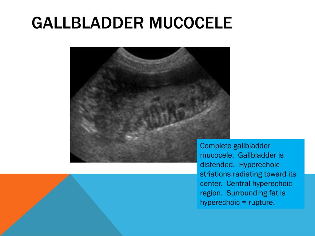PPT - Practical Ultrasound: Recognition of Surgical Disease PowerPoint ...