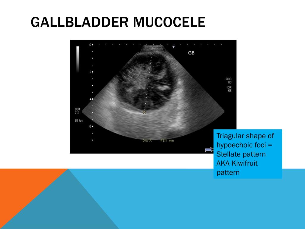 PPT - Practical Ultrasound: Recognition of Surgical Disease PowerPoint ...