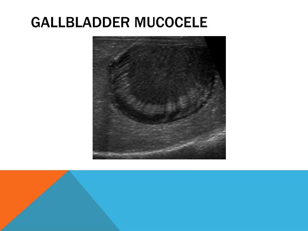 PPT - Practical Ultrasound: Recognition of Surgical Disease PowerPoint ...