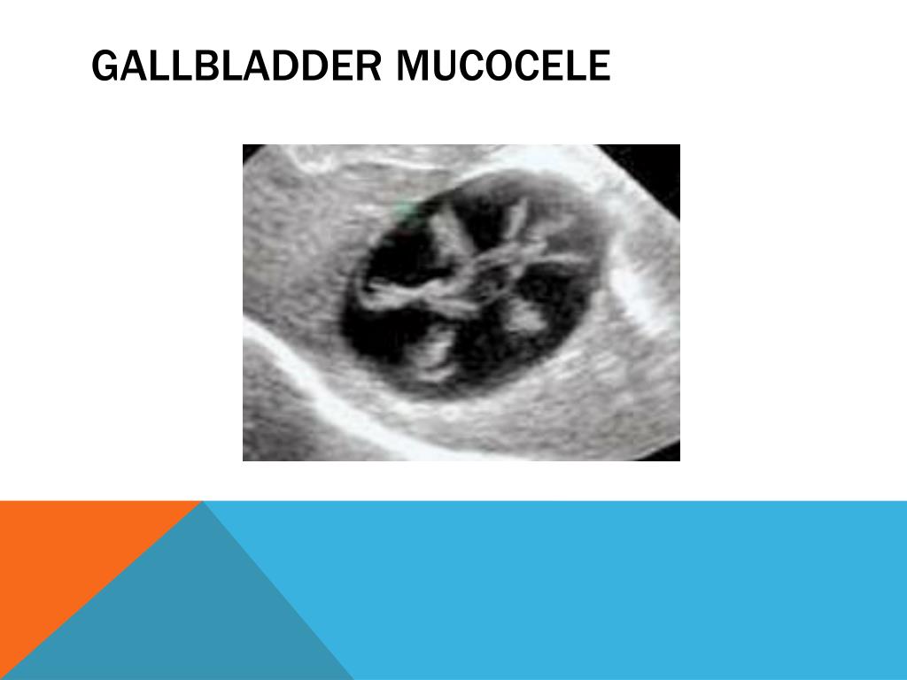 PPT - Practical Ultrasound: Recognition of Surgical Disease PowerPoint ...