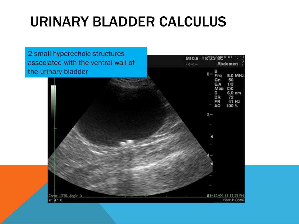 PPT - Practical Ultrasound: Recognition of Surgical Disease PowerPoint ...