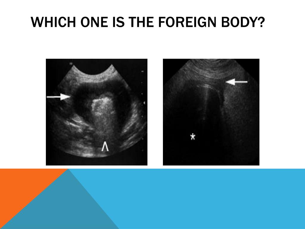 PPT - Practical Ultrasound: Recognition of Surgical Disease PowerPoint ...