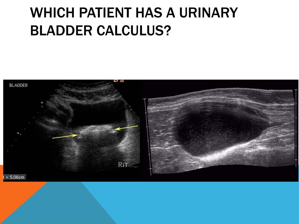 PPT - Practical Ultrasound: Recognition of Surgical Disease PowerPoint ...