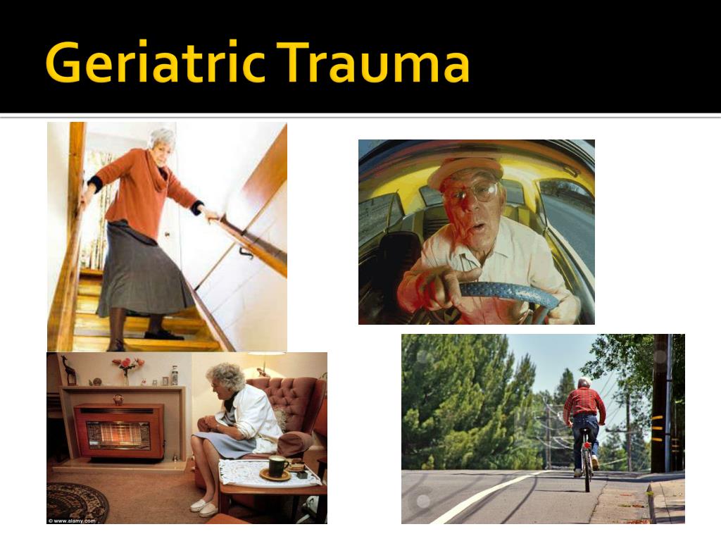 PPT - The Elderly Trauma Patient Trauma Care Beyond the ED PowerPoint ...