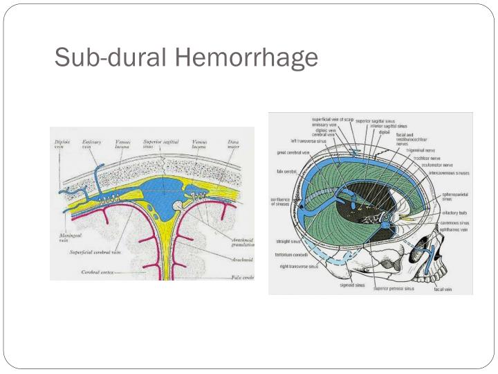 PPT - Blood Supply of Brain and Spinal Cord Lecture: 17 PowerPoint ...