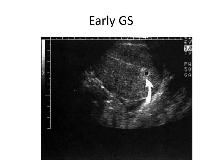 PPT - Radiological Imagings in gynecology and obstetric PowerPoint ...
