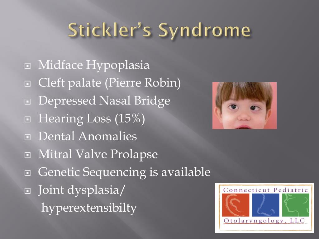 PPT - Review of Otolaryngology related Pediatric Syndromes PowerPoint ...