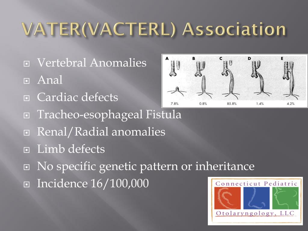 PPT - Review of Otolaryngology related Pediatric Syndromes PowerPoint ...