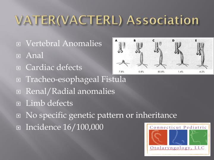 PPT - Review of Otolaryngology related Pediatric Syndromes PowerPoint ...