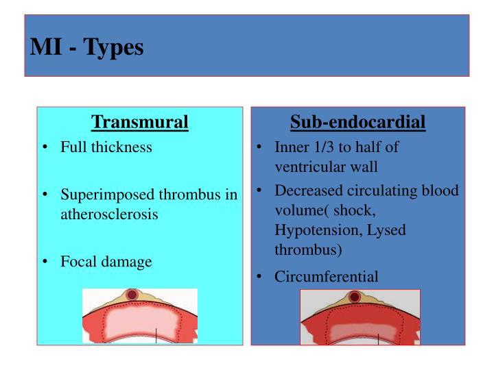 PPT - Ischemic Heart Disease PowerPoint Presentation - ID:2027189