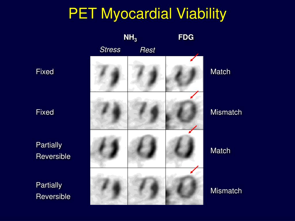 PPT - PET AND PET/CT IN ISCHEMIC HEART DISEASE PowerPoint Presentation ...