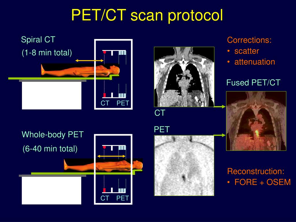 PPT - PET AND PET/CT IN ISCHEMIC HEART DISEASE PowerPoint Presentation ...