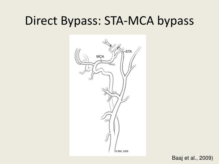 PPT - Comparison of Direct and Indirect Bypass for Moyamoya Disease ...