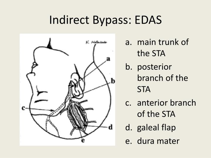 PPT - Comparison of Direct and Indirect Bypass for Moyamoya Disease ...
