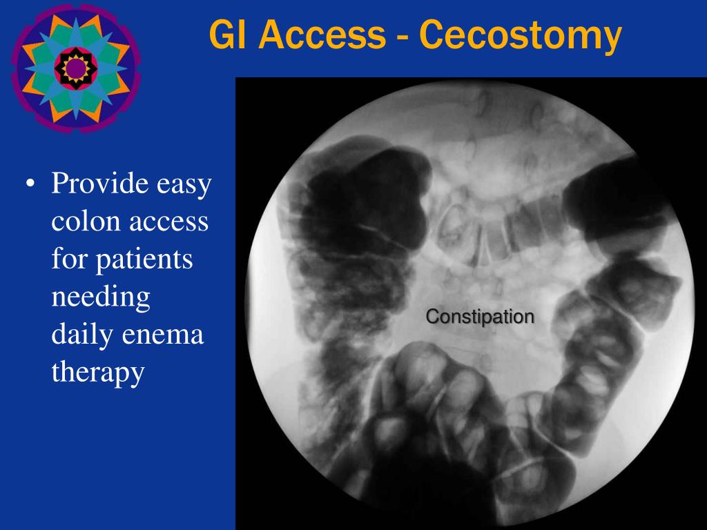 PPT - State of the Art Pediatric Interventional Radiology Brent Cully ...