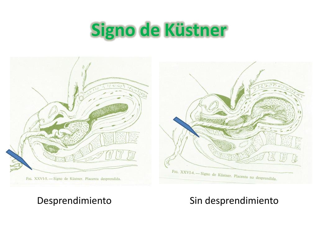 PPT - ~Atención, Parto y Puerperio~ PowerPoint Presentation, free ...