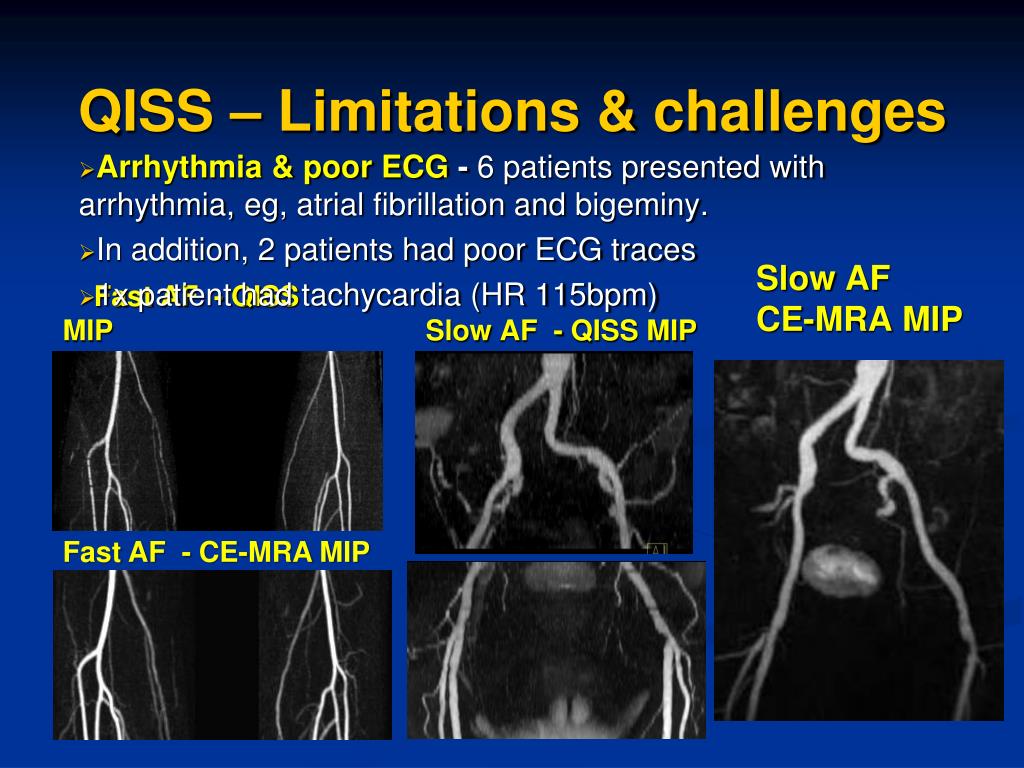 PPT - BROOKLYN 3 MRI USER GROUP Anna Marie LYNDON PowerPoint ...