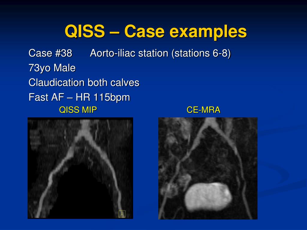 PPT - BROOKLYN 3 MRI USER GROUP Anna Marie LYNDON PowerPoint ...