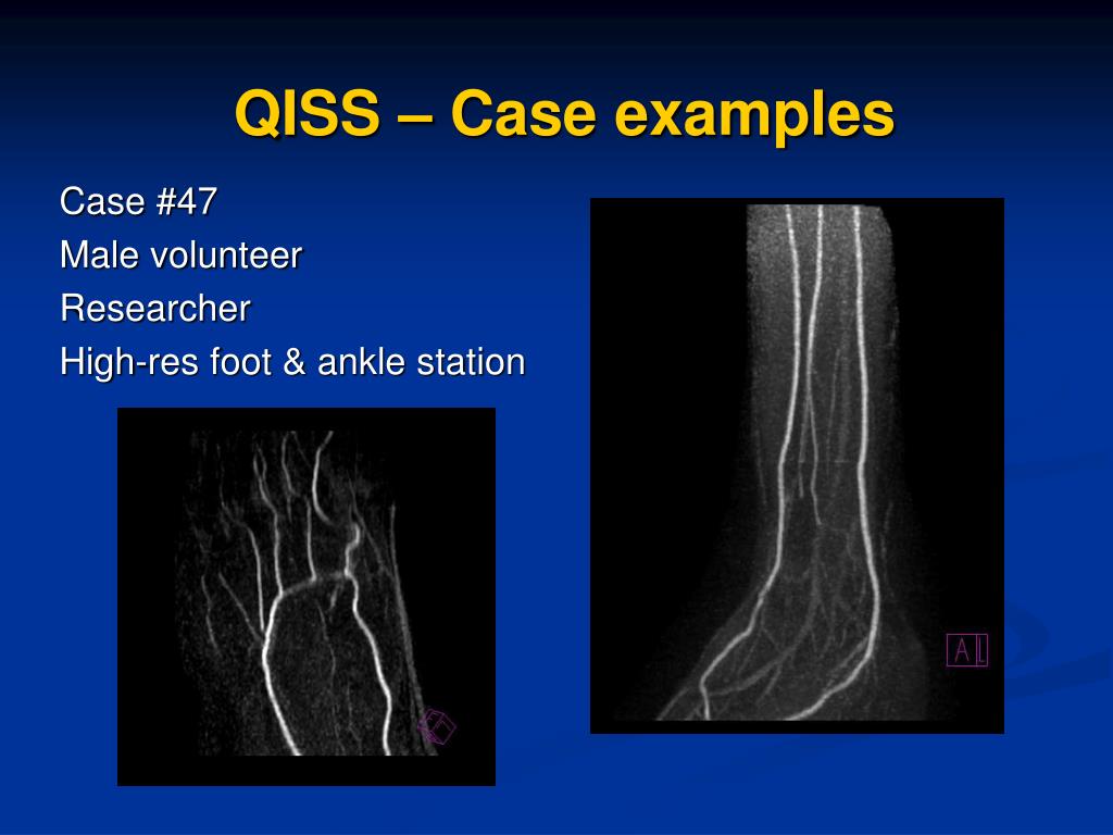 PPT - BROOKLYN 3 MRI USER GROUP Anna Marie LYNDON PowerPoint ...