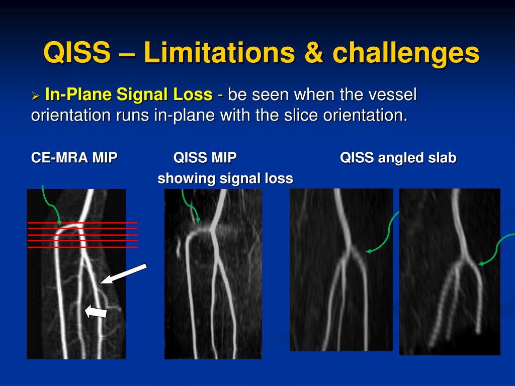 PPT - BROOKLYN 3 MRI USER GROUP Anna Marie LYNDON PowerPoint ...